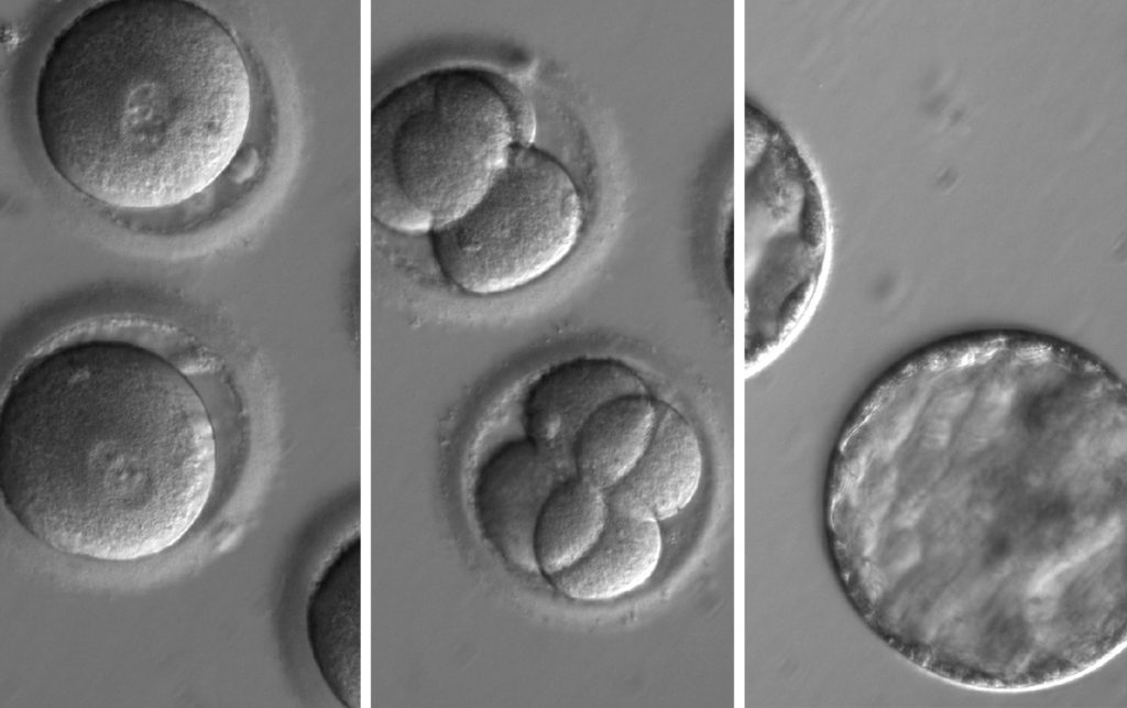 CRISPR used to edit embryos — Expert Reaction - Science Media Centre