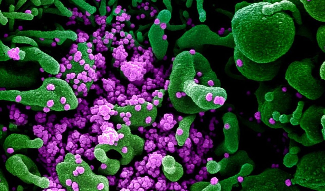 Viral mutations, lineages, and strains - Expert Reaction - Science ...